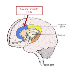 Brain Morphometry Separates Bipolar vs Unipolar - Gateway Psychiatric