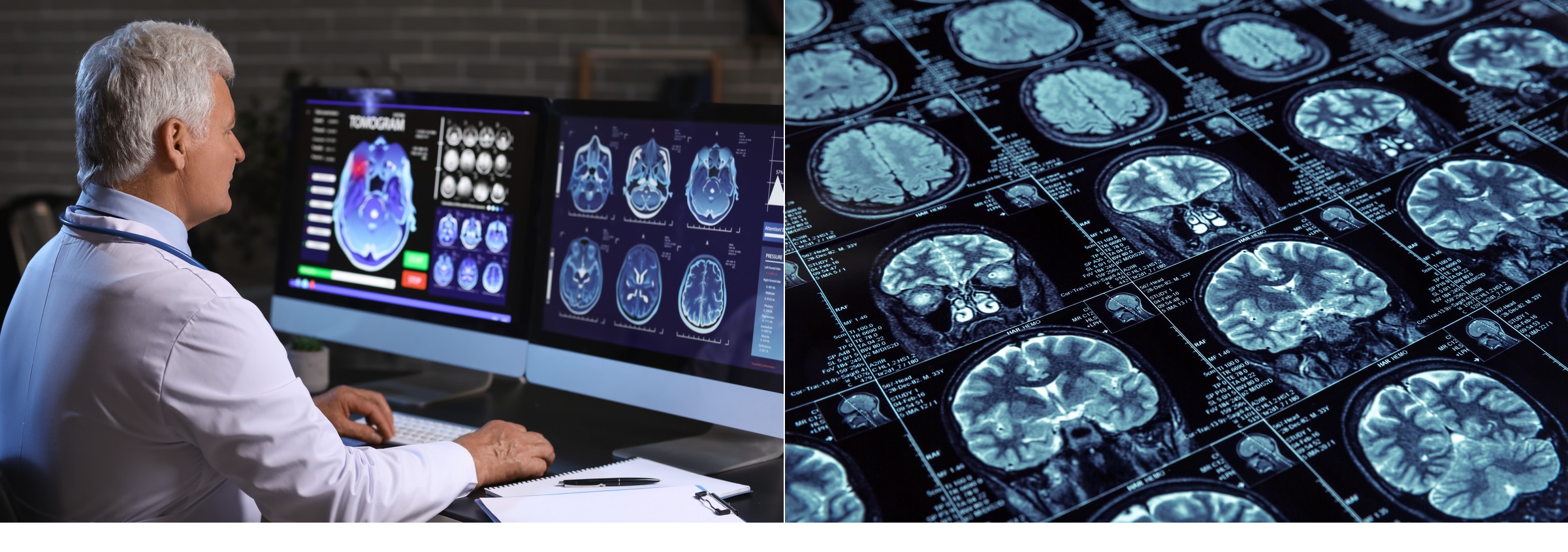 Brain Imaging-Based Biomarker of Depression Identified - Gateway ...